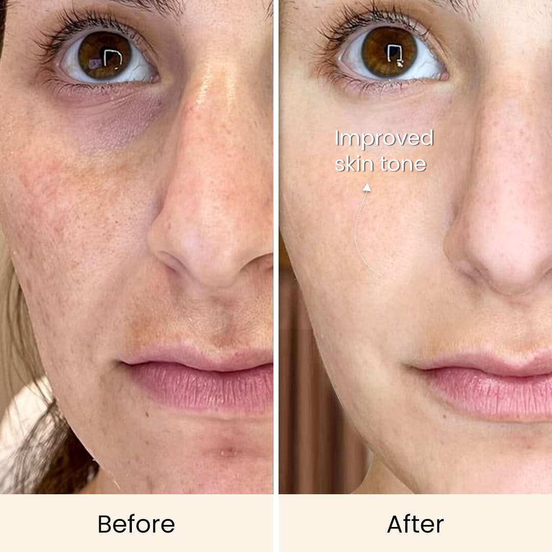 AMIRO Spectra 5 in 1 LED Skin Tightening Light Mask