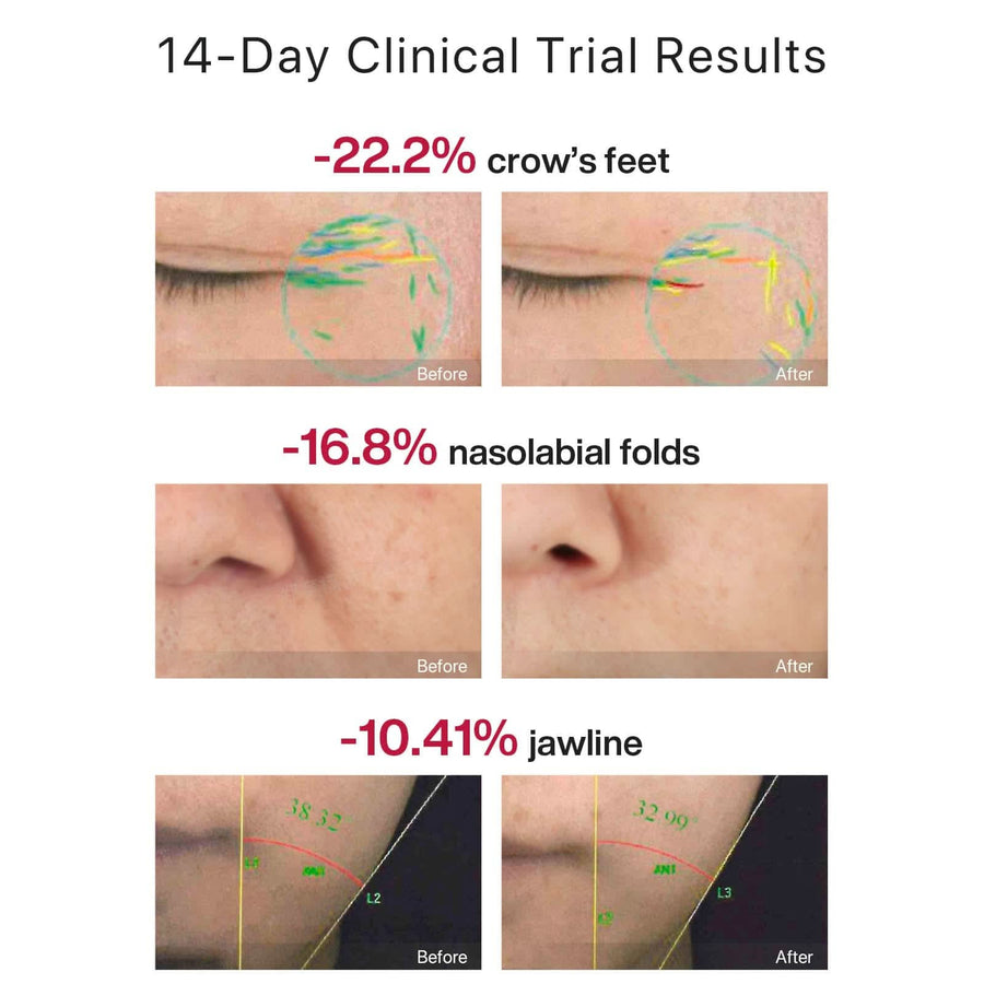 AMIRO R1 Lift Facial RF Skin Tightening Device